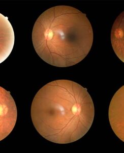 Comprehensive Eye Care | Ottawa | Medview Optometry Clinic